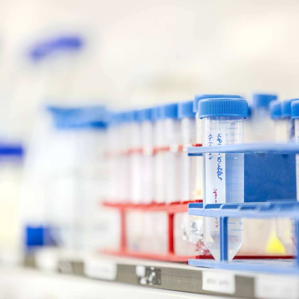 Hbo-opleiding Biologie en Medisch Laboratoriumonderzoek overzicht van ...